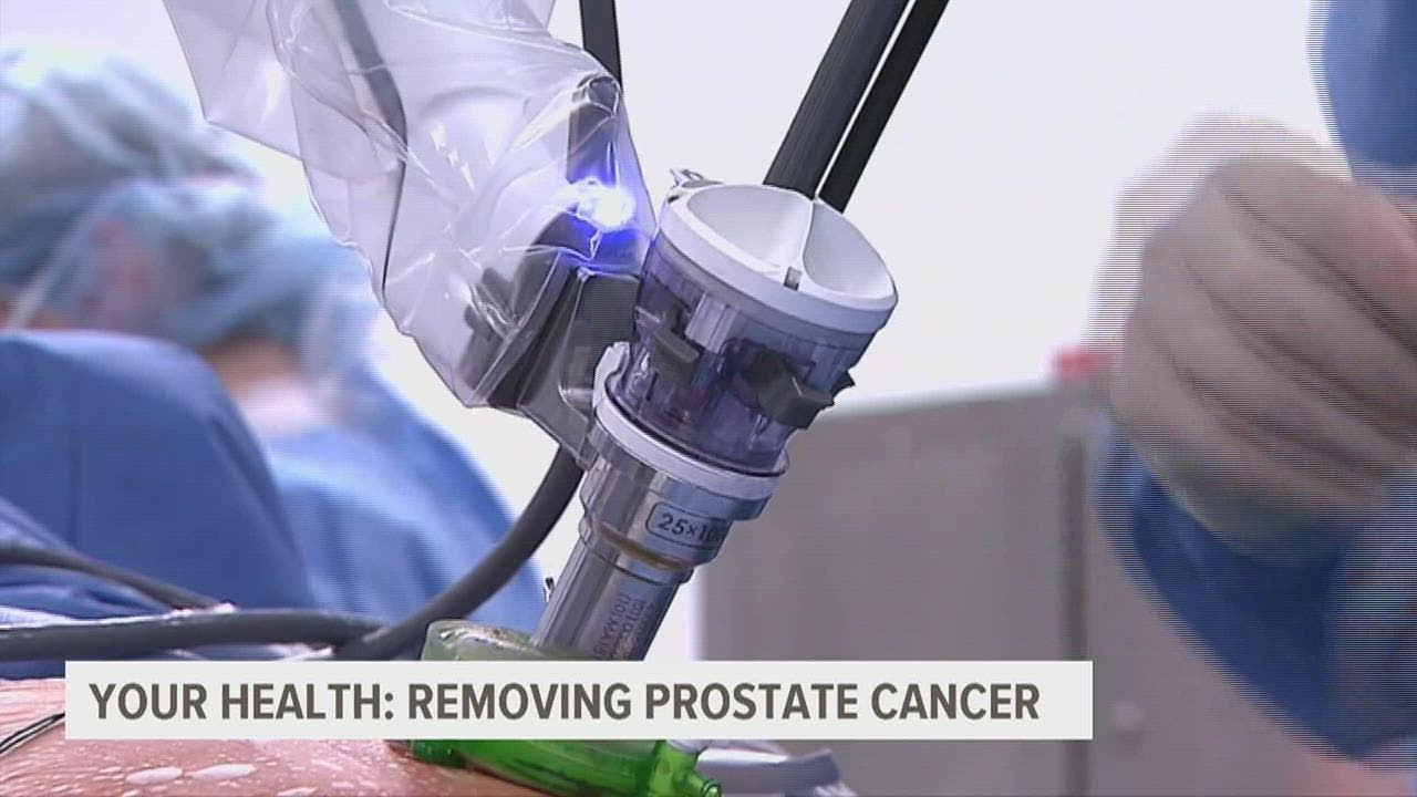 First-of-its-kind prostate cancer surgery goes through the bladder ...