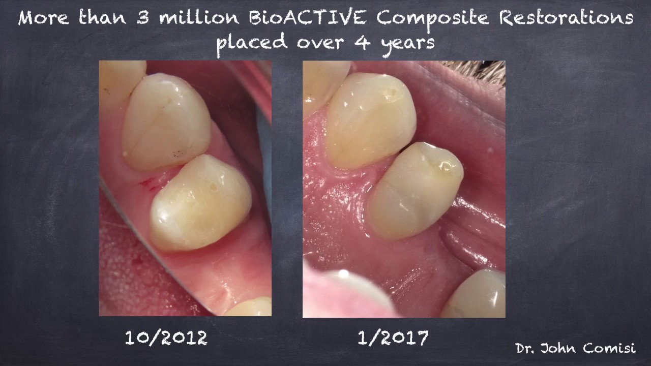 What is Bioactivity? Why Does it Matter? - YouTube