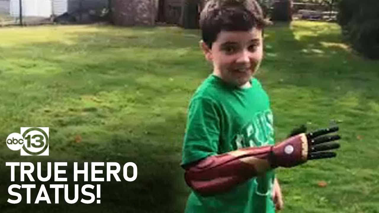 8-year-old boy gets Marvel-themed bionic arm - YouTube