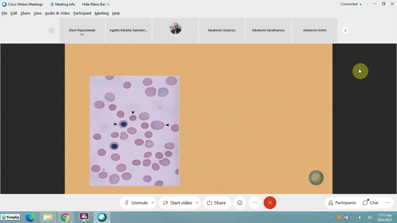ΔΙΑΤΑΡΑΧΕΣ ΕΡΥΘΡΟΚΥΤΤΑΡΩΝ & ΑΙΜΟΣΤΑΣΗΣ - YouTube