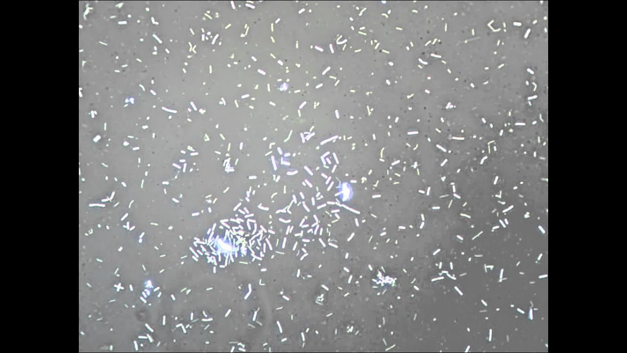 Zoogloea - Alchetron, The Free Social Encyclopedia