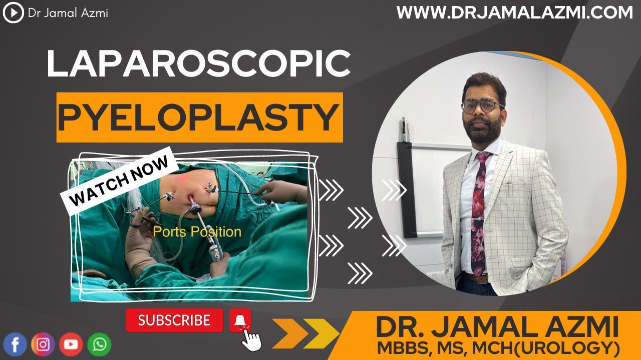 Laparoscopic Pyeloplasty for Pelvic Ureteric Junction Obstruction | Dr ...