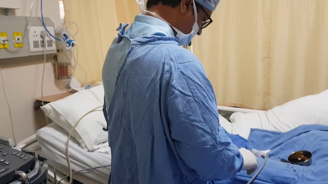 Liver abscess pigtail drainage due to ruptured GB empyema. - YouTube