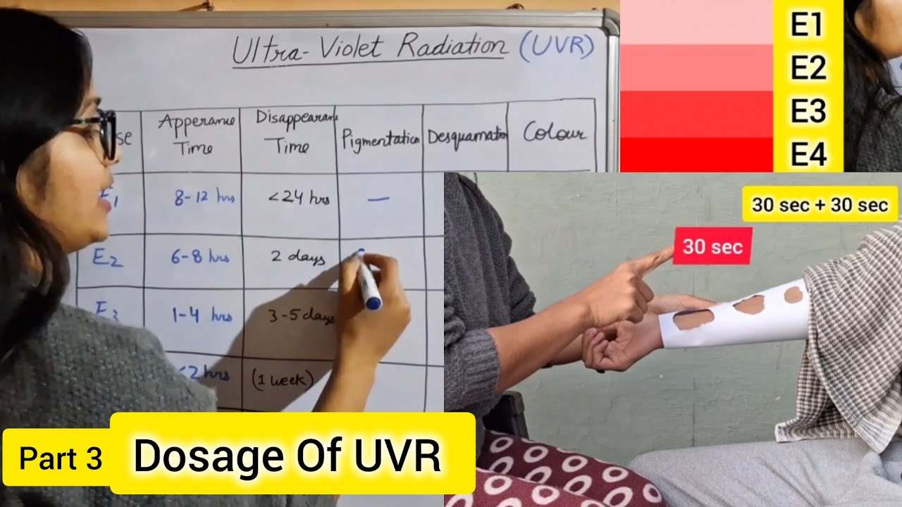 (3/3) Dosage of Ultraviolet Radiation (UVR ) Electrotherapy | Dosage of ...