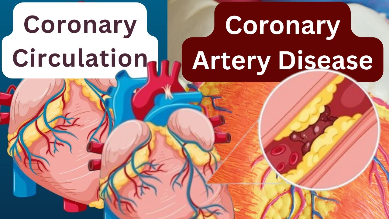 Coronary Circulation and Coronary Artery Disease (CAD) Pt.3 - YouTube