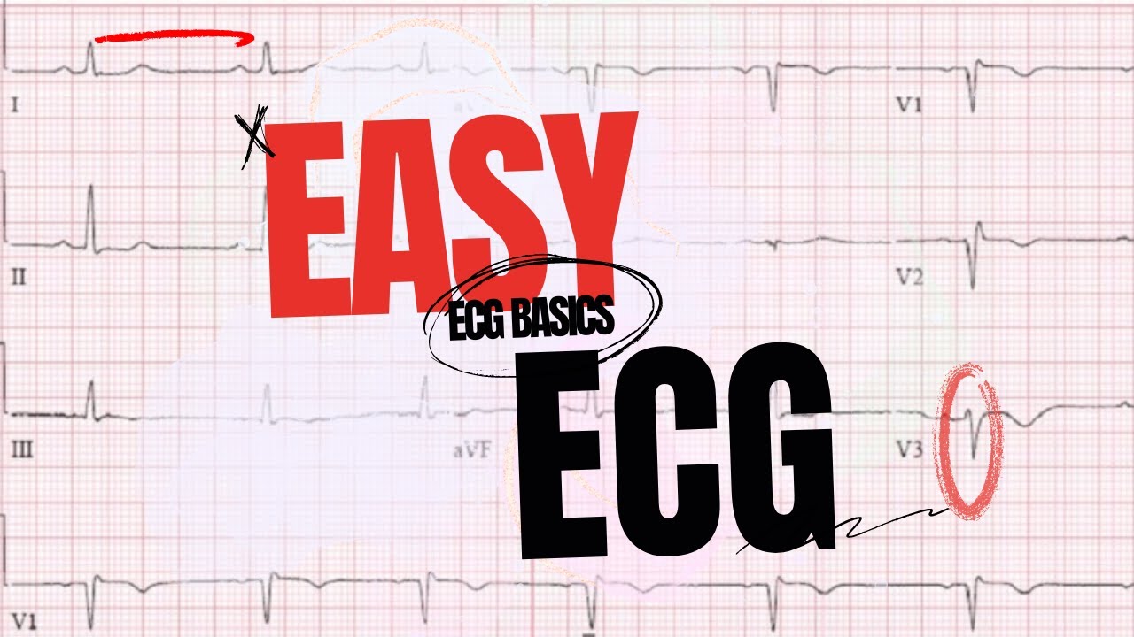 Step by Step method to Read ECG | ECG BASICS | Diagnosing Myocardial ...