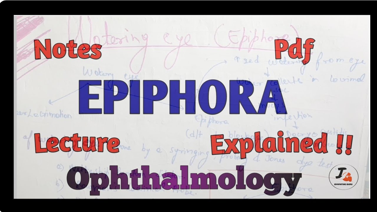 Epiphora Ophthalmology - YouTube