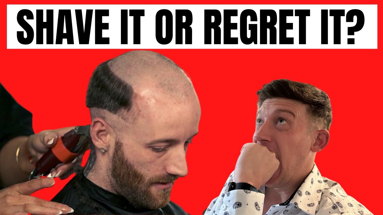 Before You Shave Your Head for a Hair System… Watch This First ...