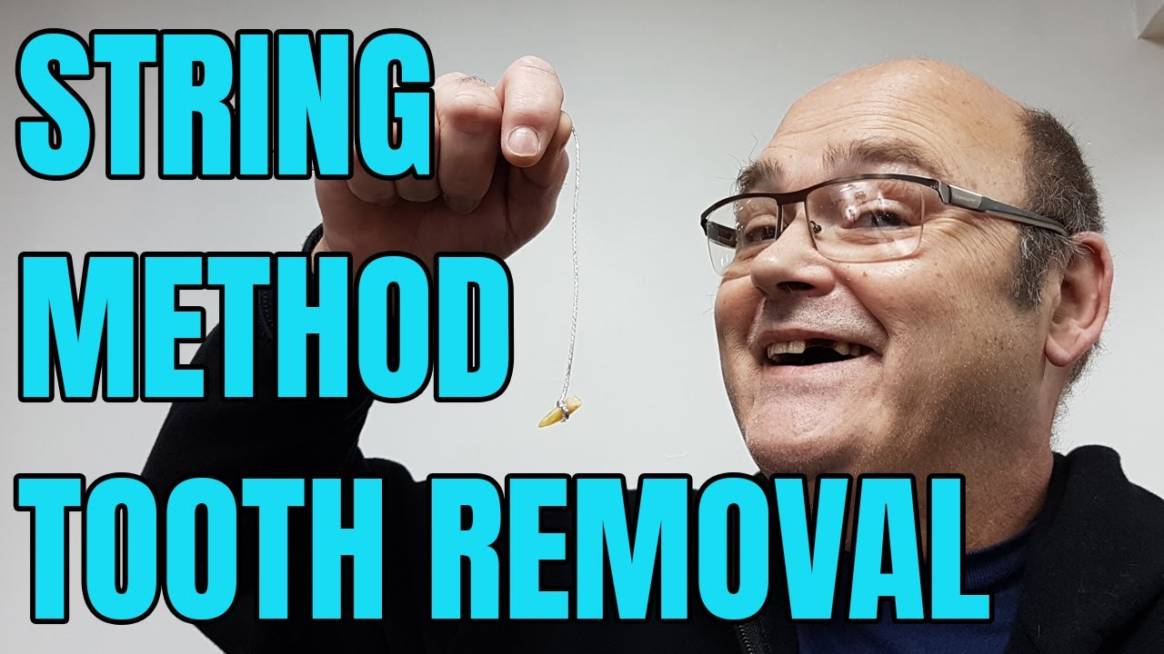 Tooth removal with string - YouTube
