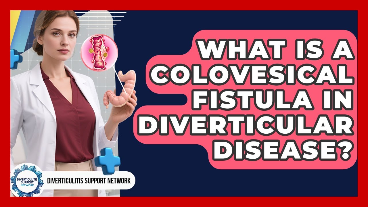 What Is A Colovesical Fistula In Diverticular Disease? - Diverticulitis ...