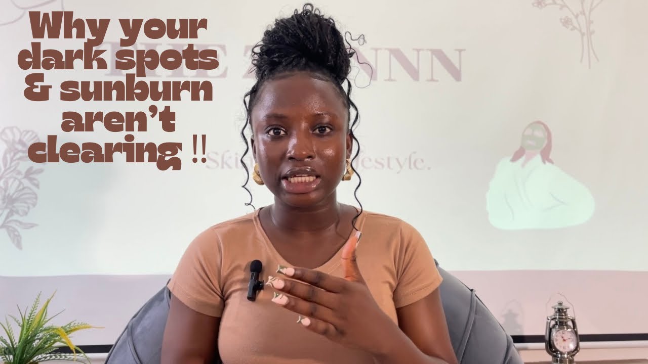 Why your dark spots/sunburn isn’t fading +Effective ways to treat ...