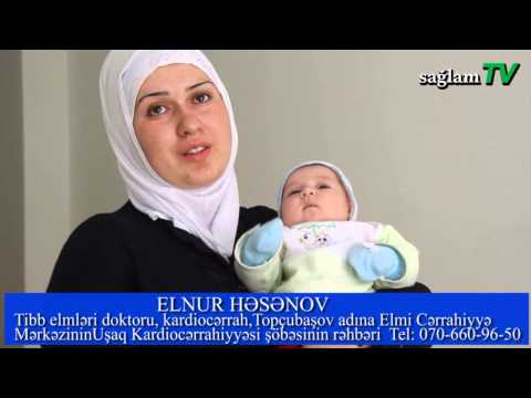 Elnur Hasanov. Childrens cardio surgery.  Uşaq ürək cərrahiyyəsi. Kardiocərrahiyyə.  saglamTV