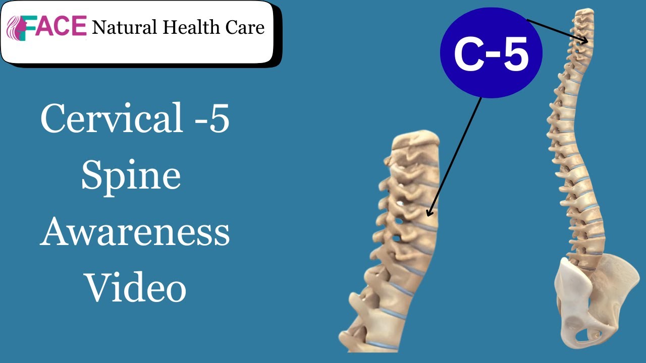 Cervical 5 spine awareness video By Face Natural Health Care - YouTube