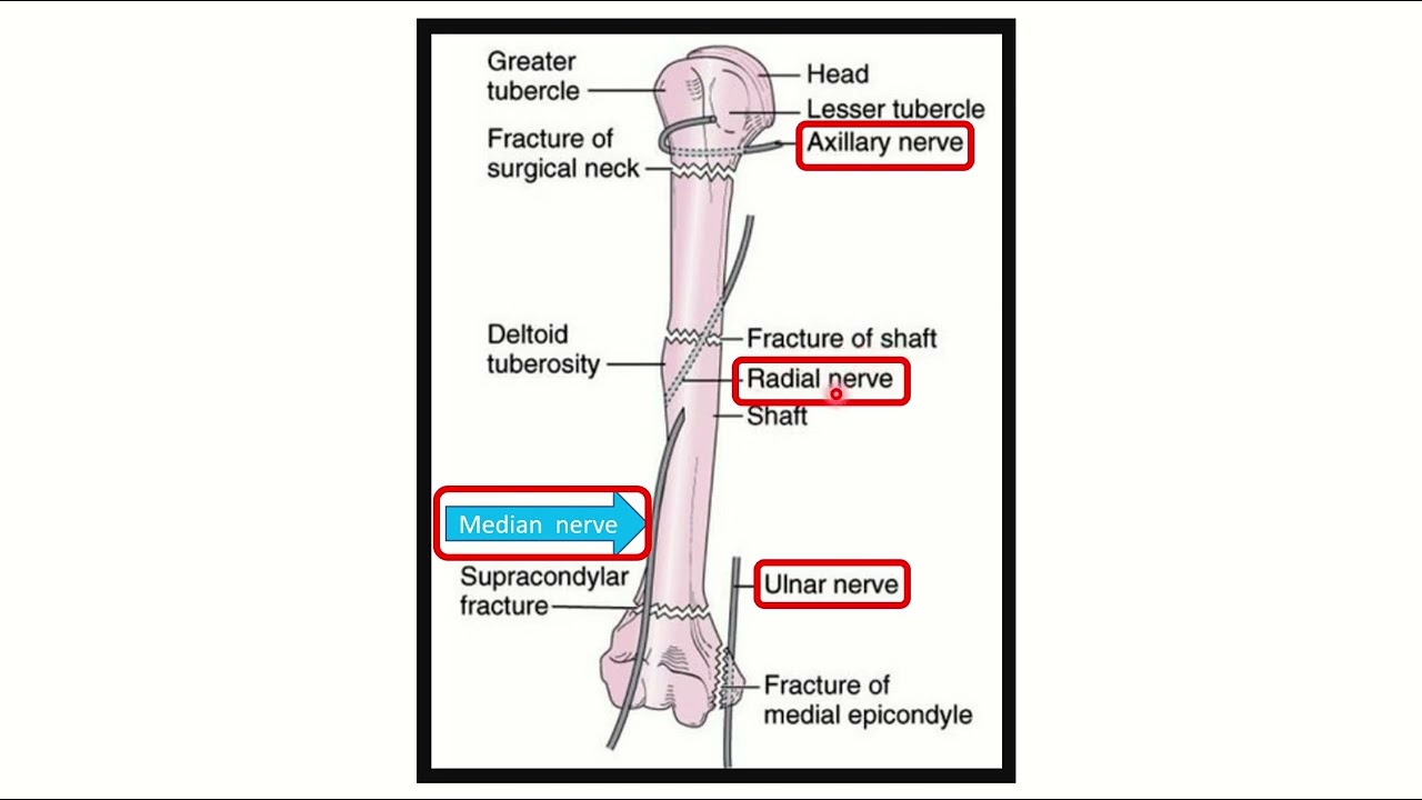 Humerus surgery nerve injury MRCS question solve (CRACK MRCS) - YouTube