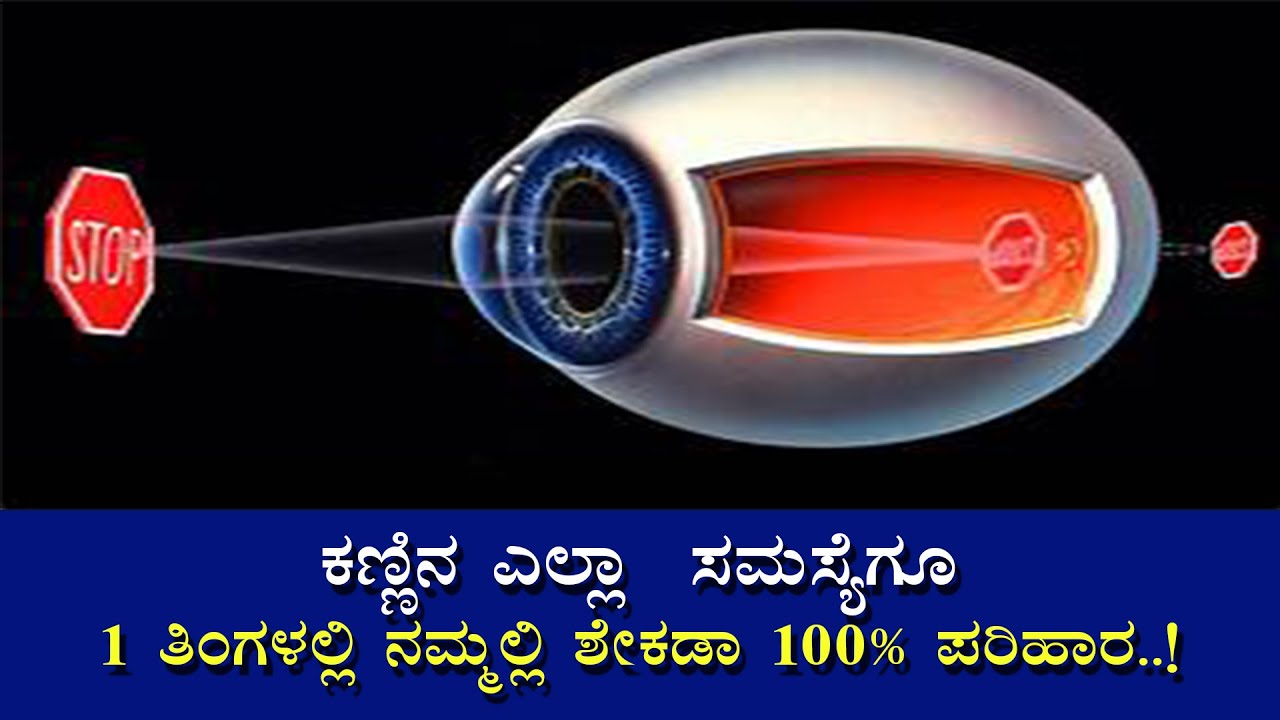 Treatment for eyesight | Solution for all eye problems | cured in 1 ...