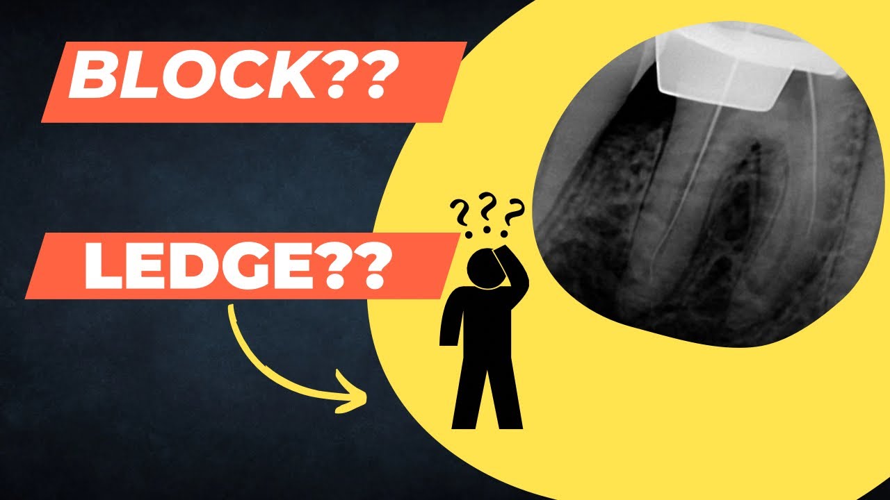 Iatrogenic Errors - YouTube