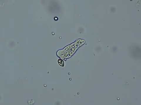 Amoeboid motion of Amoeba proteus - YouTube