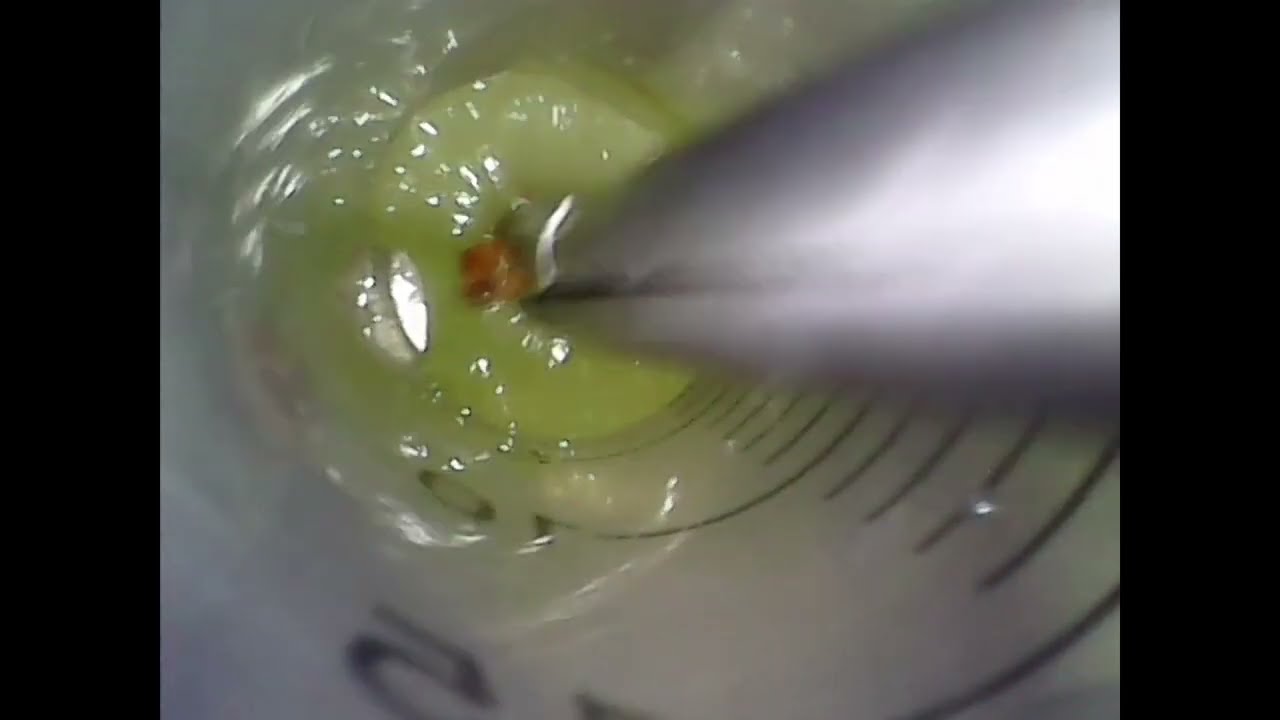 Low -cost endoscopic training module - YouTube