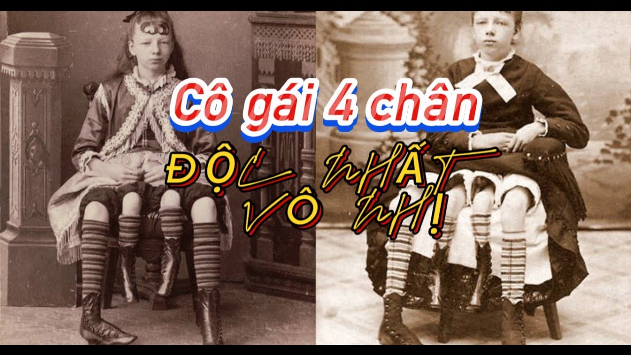 Josephine Myrtle Corbin: The Four-Legged Woman Who Was Men's Dream Girl ...