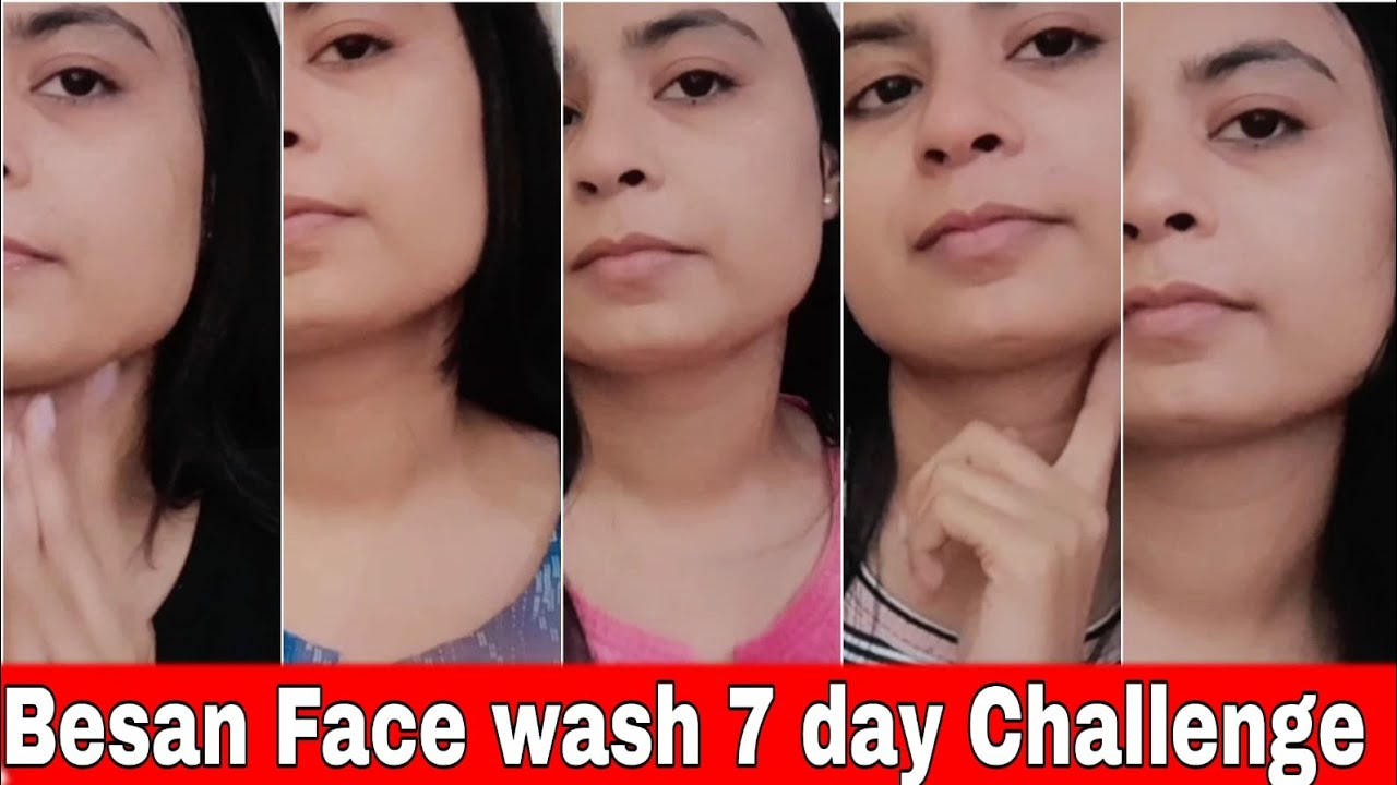 I TRIED BESAN TO WASH MY FACE FOR A WEEK (SHOCKING RESULTS)😯😯😯 ️ ️ ️ ️# ...