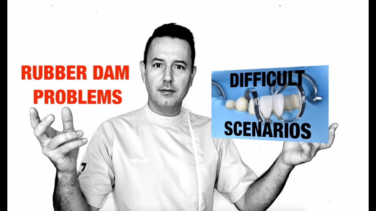 HOW TO USE RUBBER DAM IN THE MOST DIFFICULT SCENARIOS - YouTube