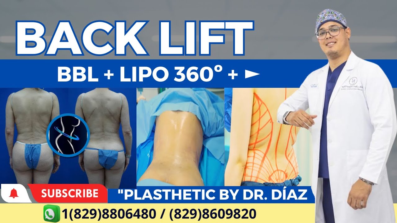 🔥 Back Lift: 🔥 BBL + LIPO 360º + "PLASTHETIC BY DR. DÍAZ - YouTube