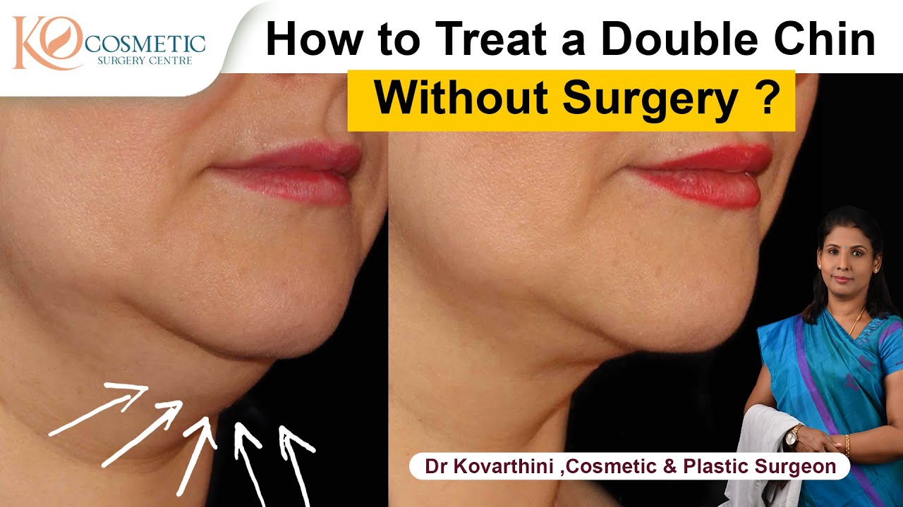 How to Treat a Double Chin Without Surgery ?Ko Cosmetic Surgery Centre ...