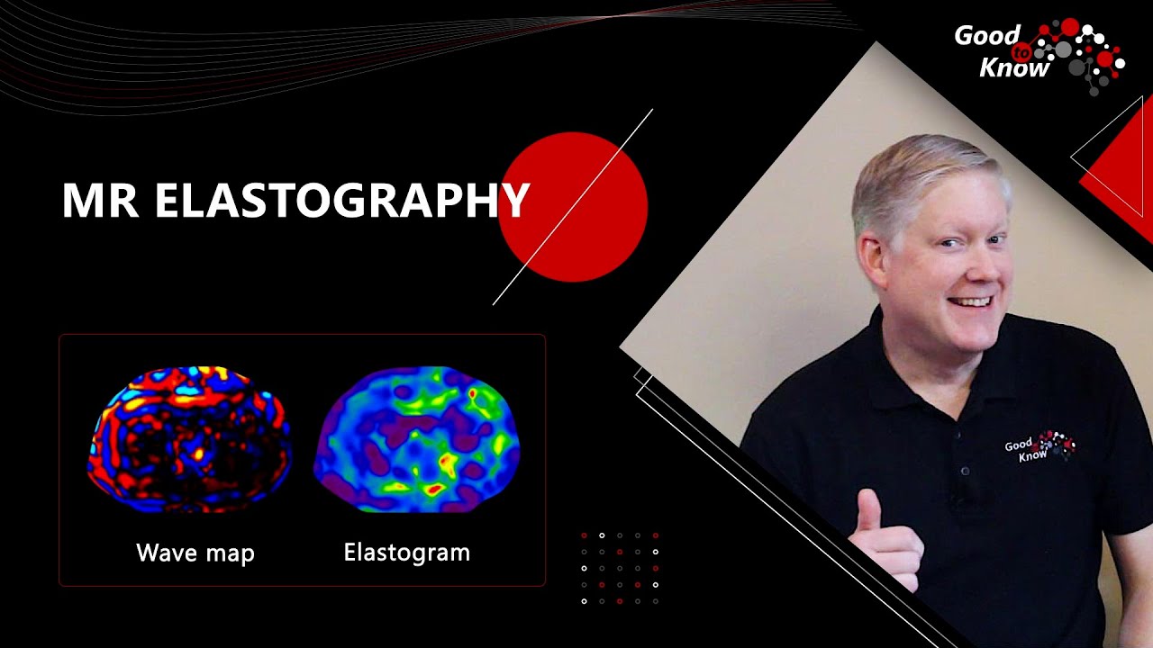 Good To Know -MR Elastography - YouTube