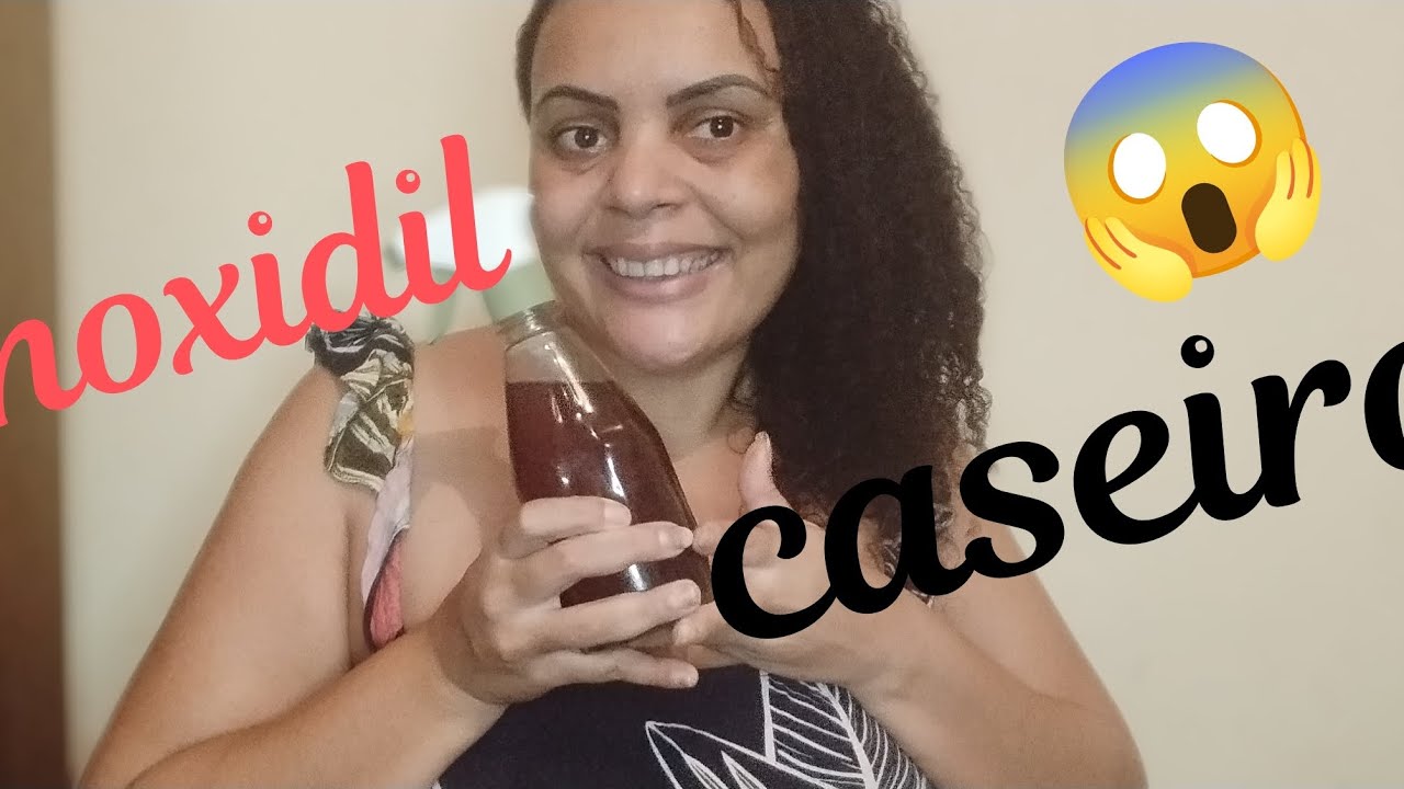 🔴MINOXIDIL CASEIRO - YouTube