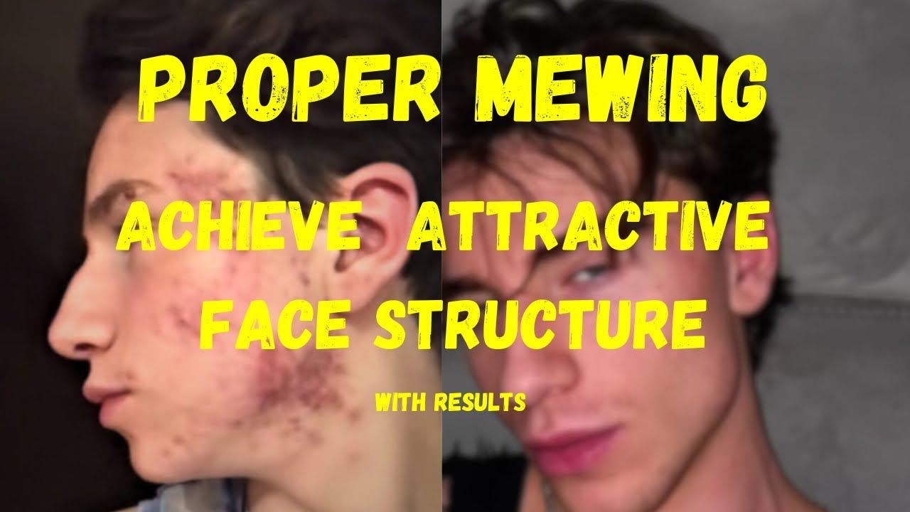 Achieve Attractive Face Structure (Mewing) With Before and After ...