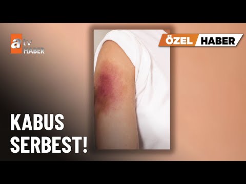 ÖZEL HABER – Evliliği kabus oldu, hayatından endişe ediyor  - atv Ana Haber 12 Aralık 2025