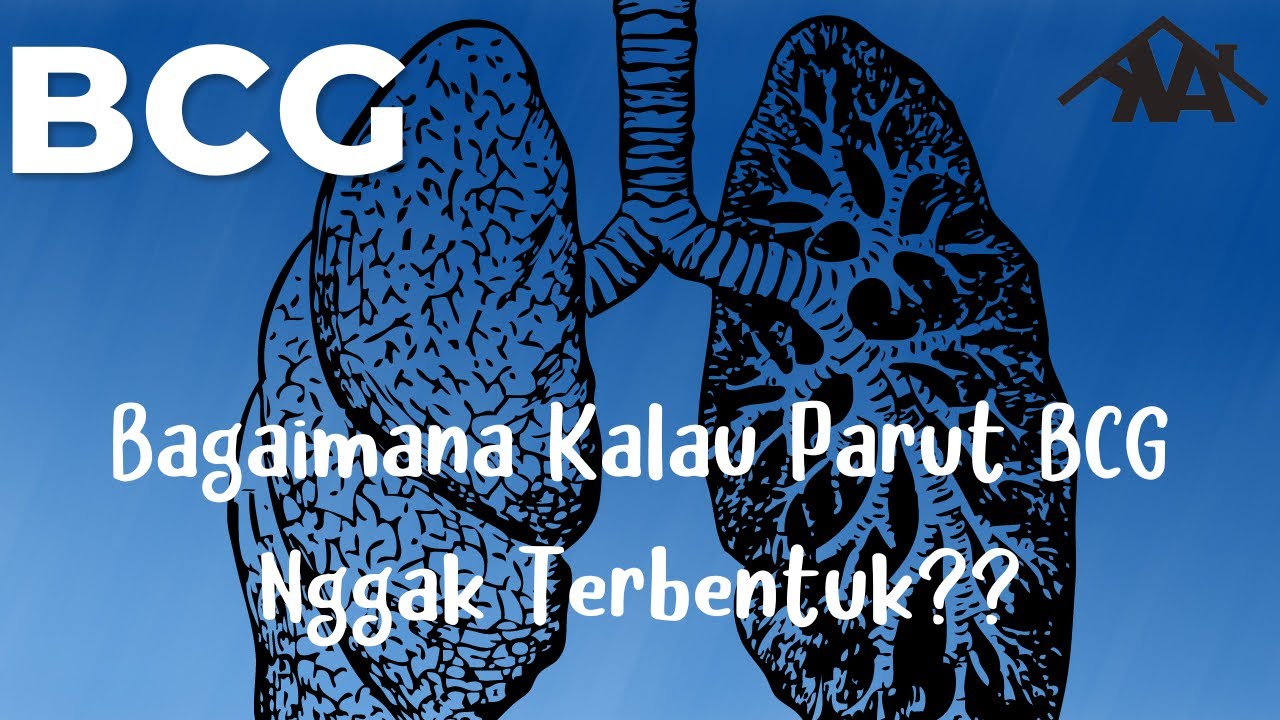 Bagaimana Jika Parut BCG Tidak Terbentuk? - YouTube