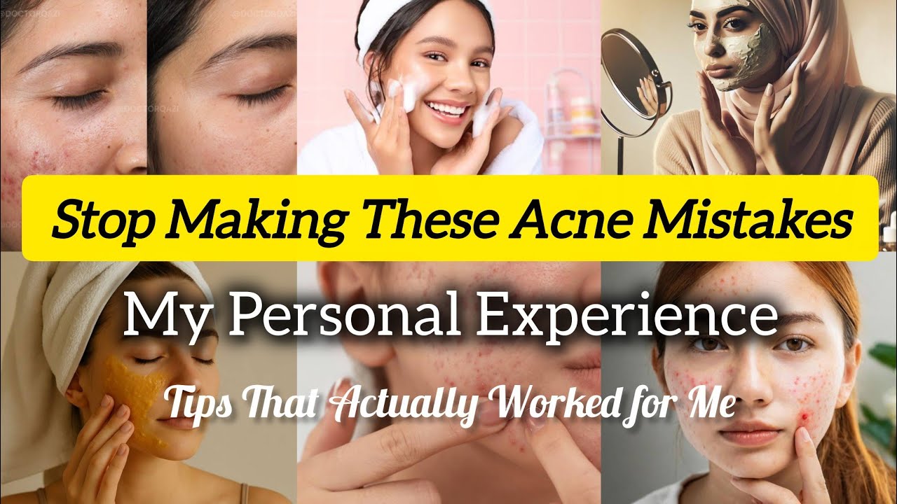 How to Reduce Acne Without Scars| Acne Solutions That Actually Work ...