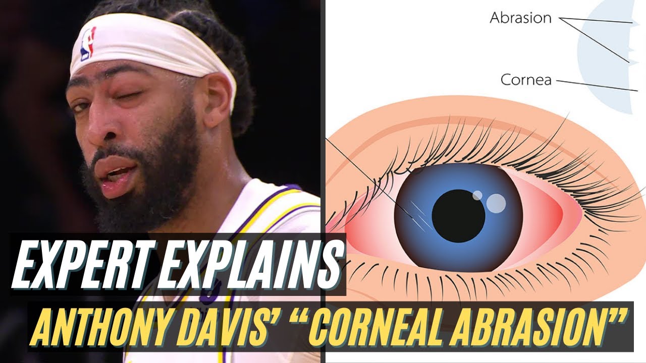 Expert Explains Anthony Davis Eye Corneal Abrasion & Timeline - YouTube