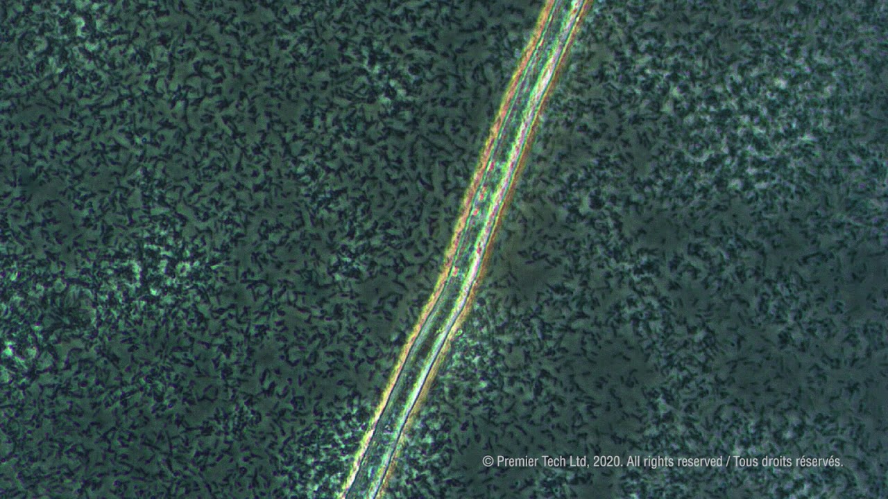 Bacillus Bacteria in Action Inside an Hypha - YouTube