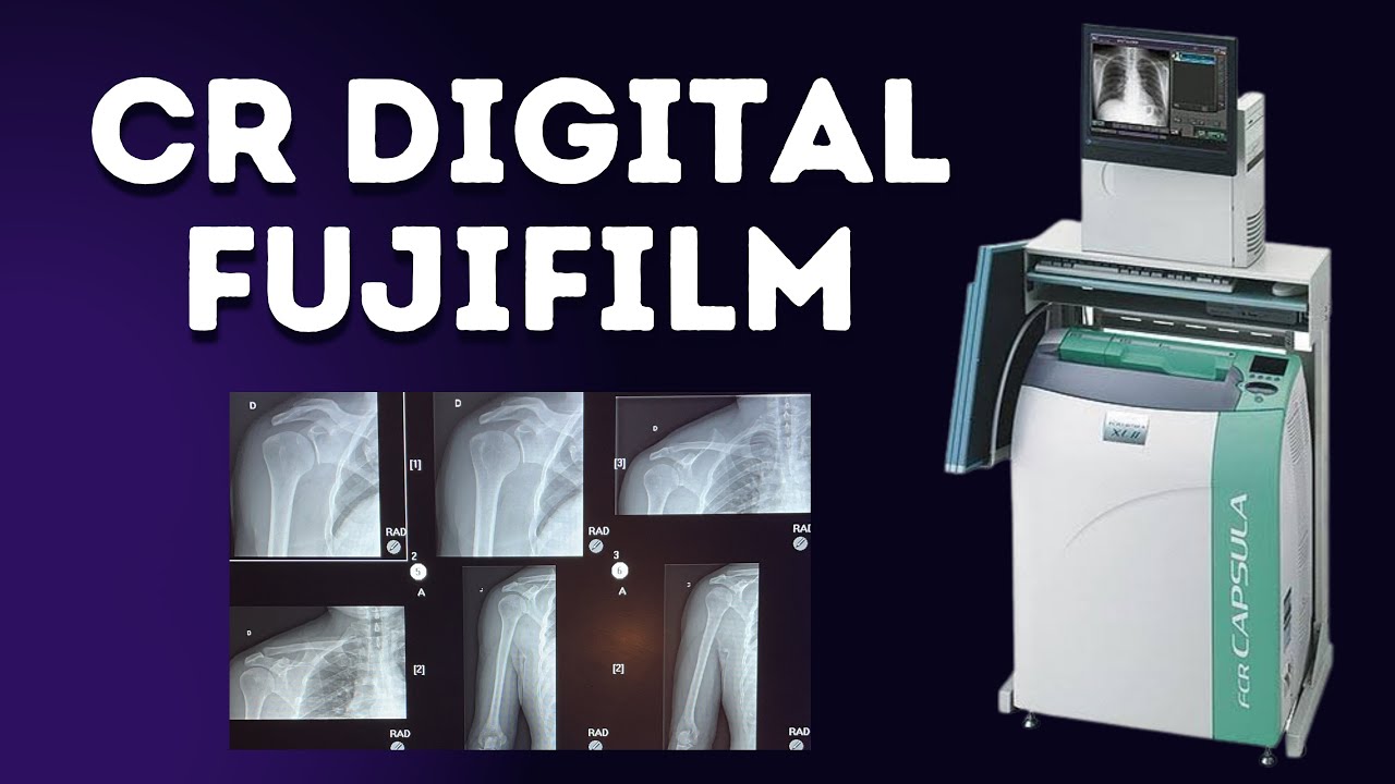 Sistema digital CR Fugifilm. RADIOLOGIA - YouTube