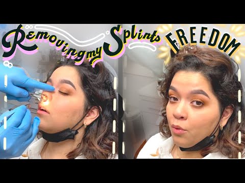 Septoplasty Splint Removal - YouTube