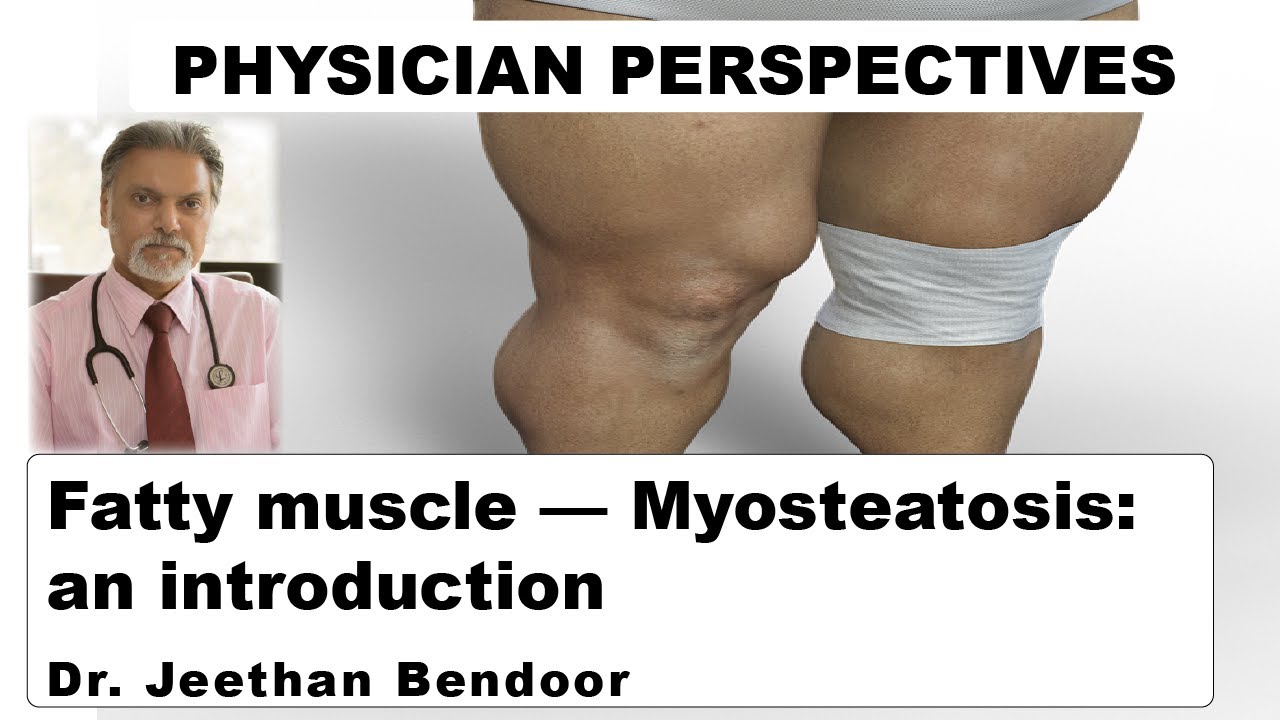 Fatty Muscle, Myosteatosis an Introduction - YouTube