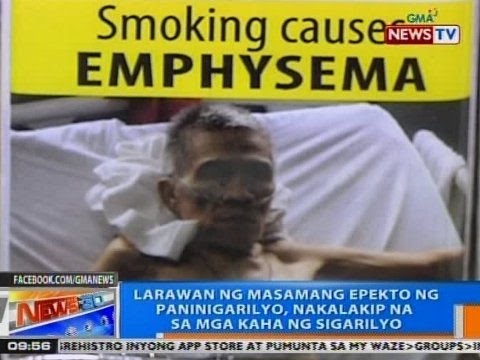 NTG: Larawan ng masamang epekto ng paninigarilyo, nakalakip na sa mga ...