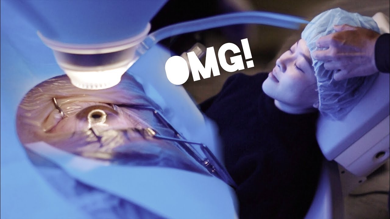 My Lasik Surgery Experience + Live Footage! | JLINHH - YouTube