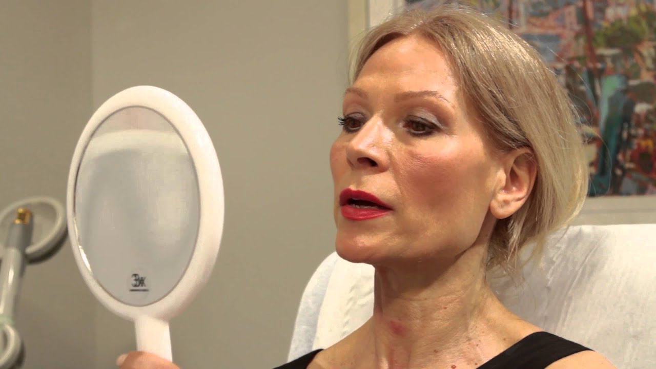 Titan Skin Tightening Treatment - YouTube