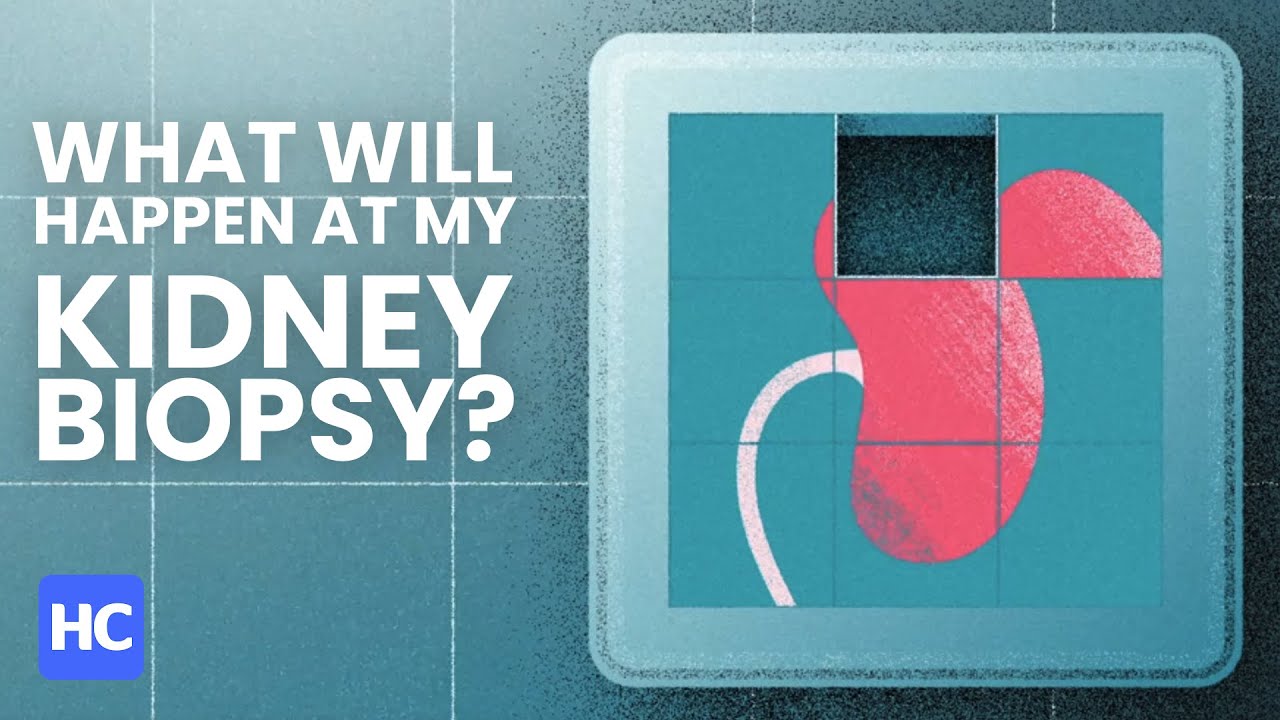 Understanding IgA Nephropathy: How Kidney Biopsies Diagnose Berger’s ...