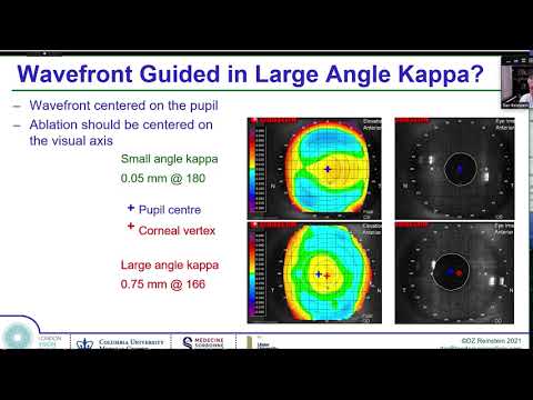 Choosing From TransPRK LASIK Wavefront Topography SMILE ICL - YouTube