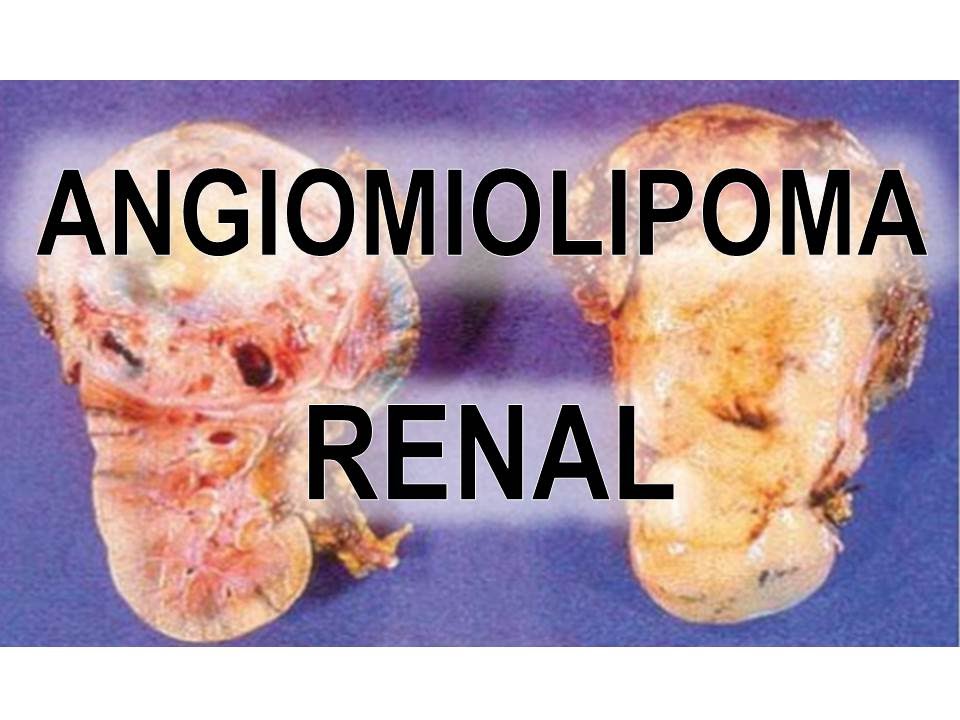 Fisiologa Renal Youtube