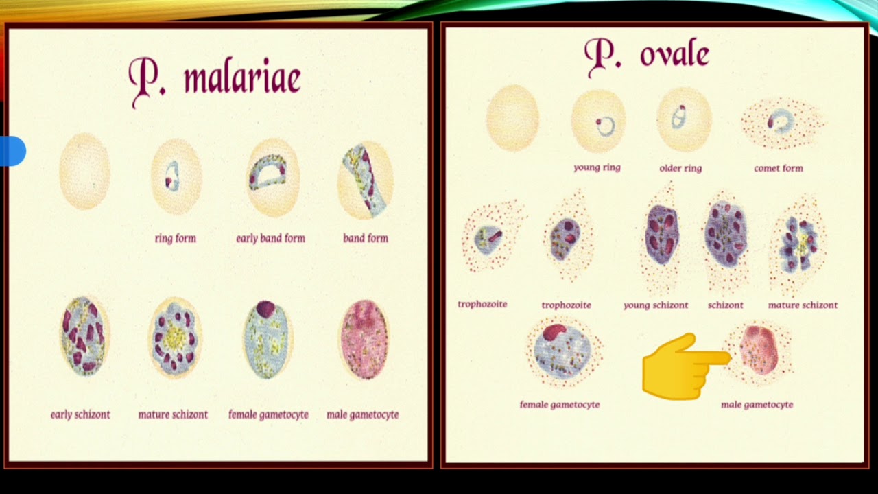 6. Identifikasi Malaria falc, vivax, malariae, ovale Edukasi ATLM (full ...
