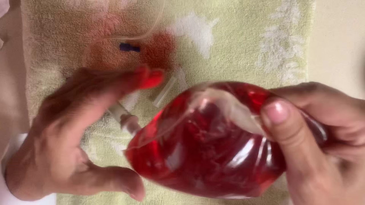 IV/Lab Draw Arm Assembly - YouTube