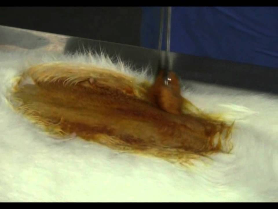 Antisepsia Yodopovidona - YouTube