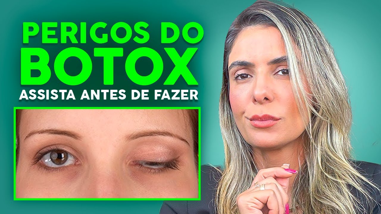 O que pode dar ERRADO na APLICAÇÃO de BOTOX? Quais as COMPLICAÇÕES do ...