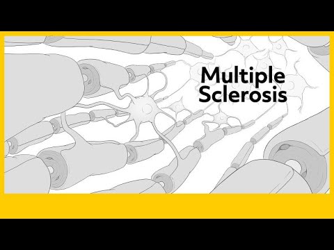 Multiple Sclerosis - YouTube