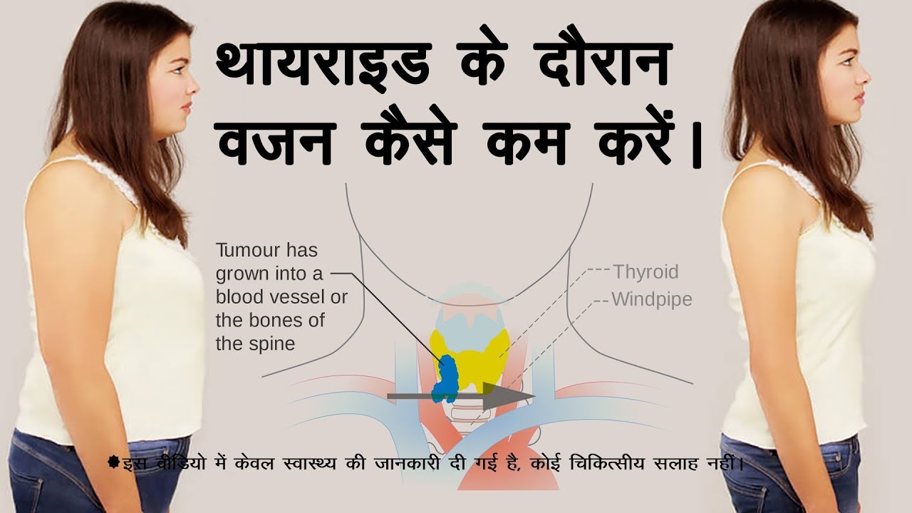 How To Weight Loss In Thyroid In Hindi how-to-weight-loss-in-thyroid-in-hindi